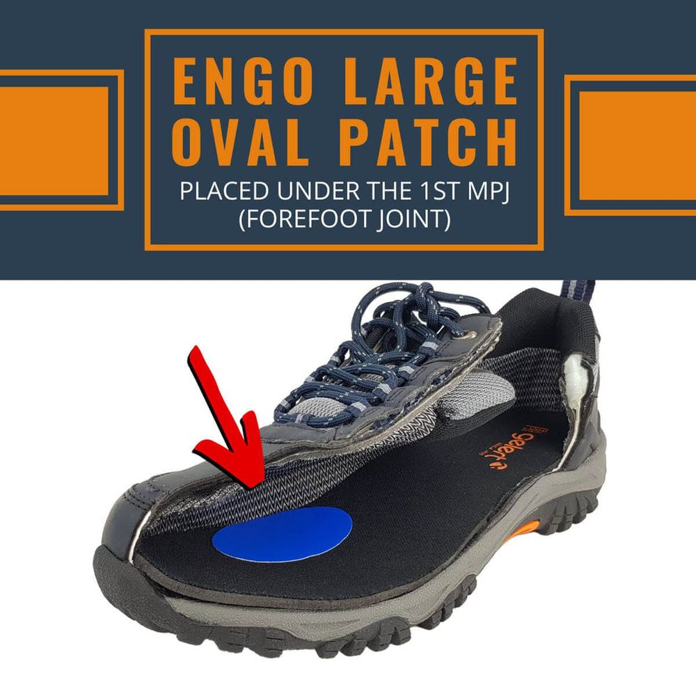 Blister Patches For Feet | Engo Blister Patches: How Do They Protect Your Skin?